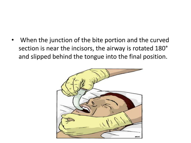 Facemask , oral and nasal airways | PPTX