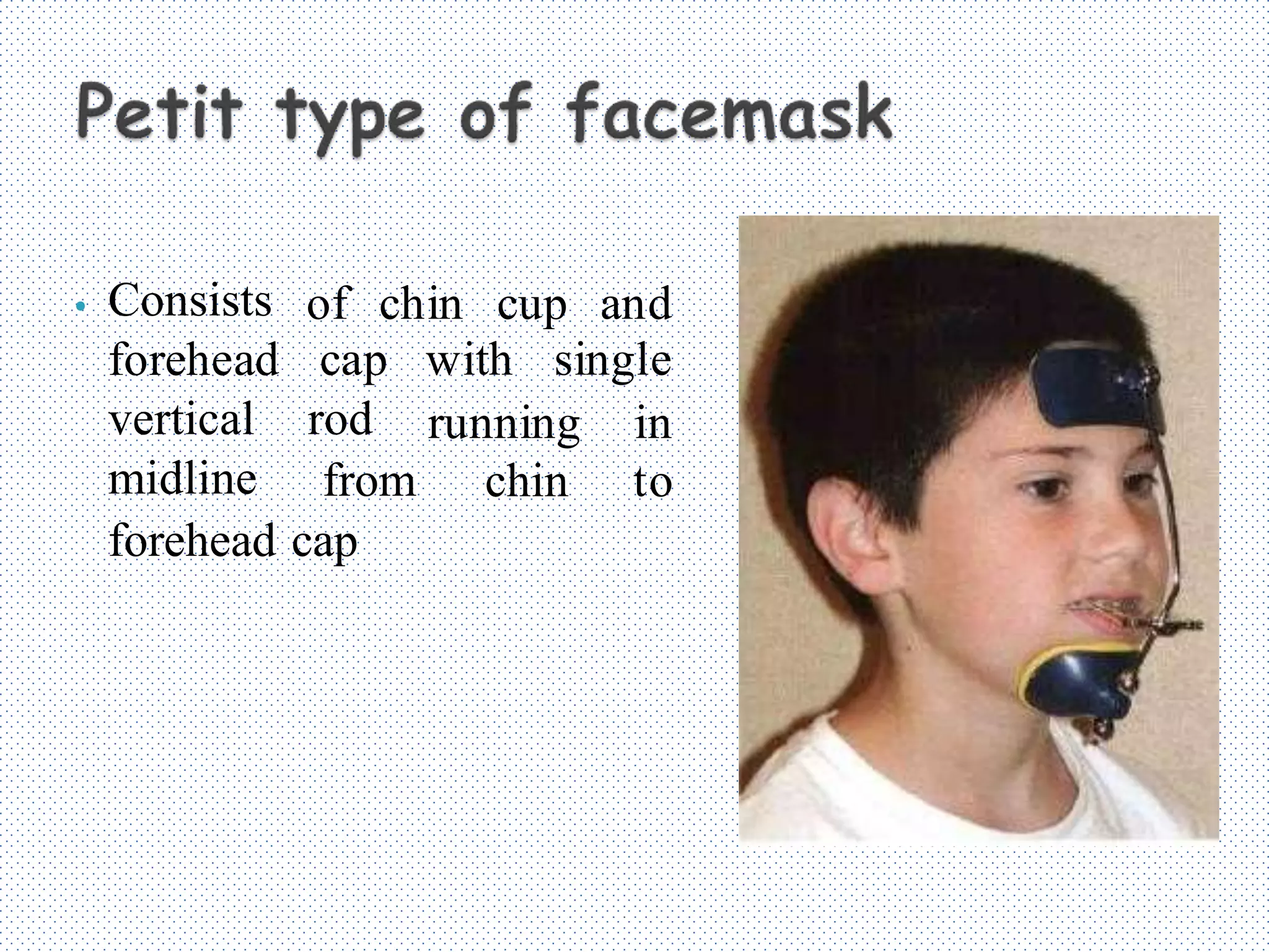 FACEMASK CHINCUP SEMINAR[1].pptx