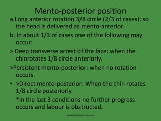Face Presentations And Positions