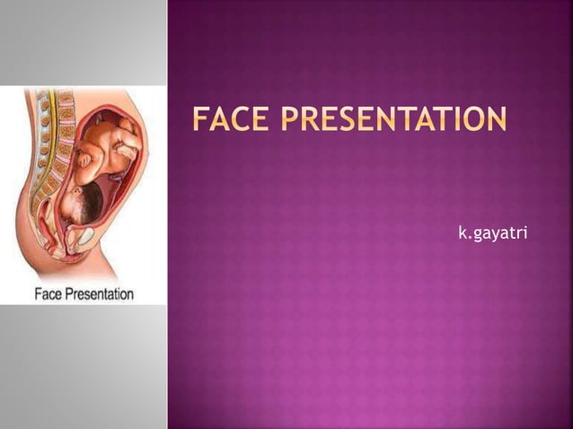 Face presentation | PPTX | Pregnancy | Reproductive Health