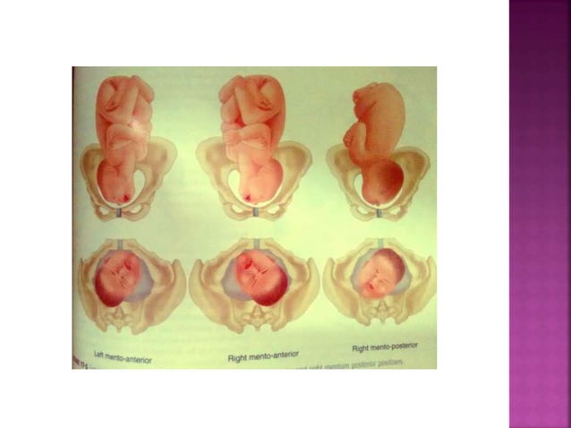 Face presentation | PPTX | Pregnancy | Reproductive Health