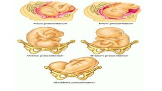 Face Presentation | PPTX