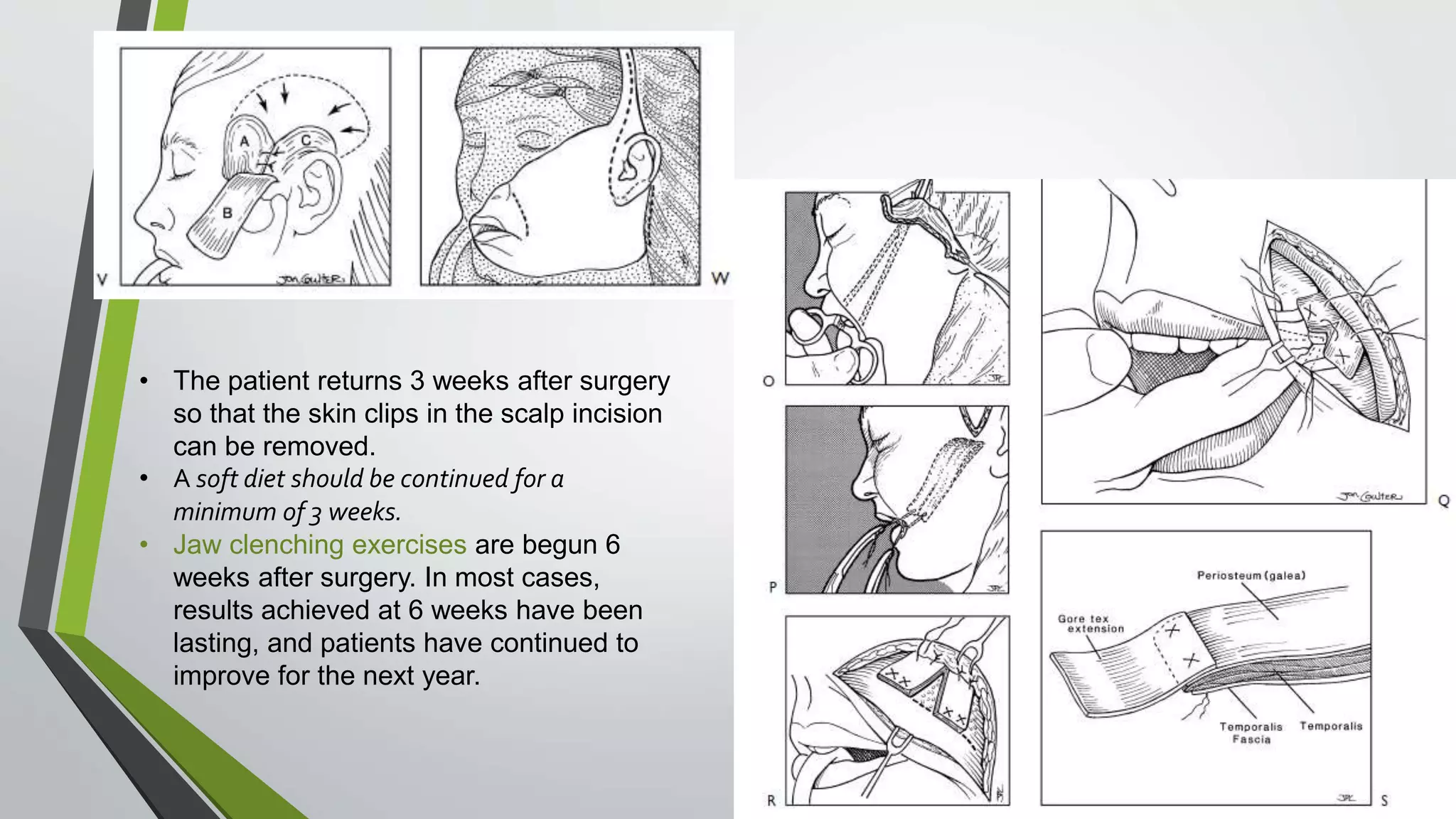 Face reanimation | PPTX
