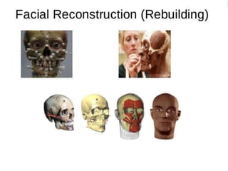 Face reconstruction | PPTX