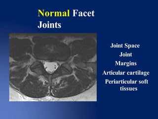 facetjointinjectioncomments-191123152135.pptx