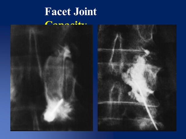 facetjointinjectioncomments-191123152135.pptx
