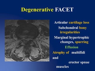 facetjointinjectioncomments-191123152135.pptx
