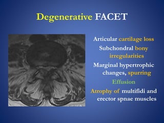 Facet joint injection | PPTX