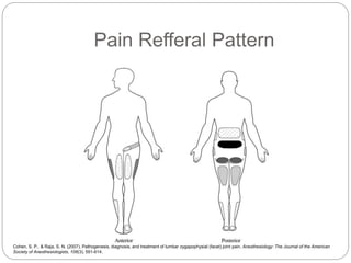 Facet Joint Pain | PPTX