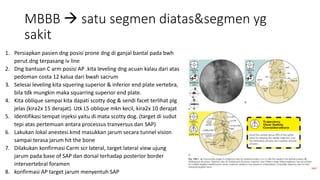 Facet joint pain.pptx