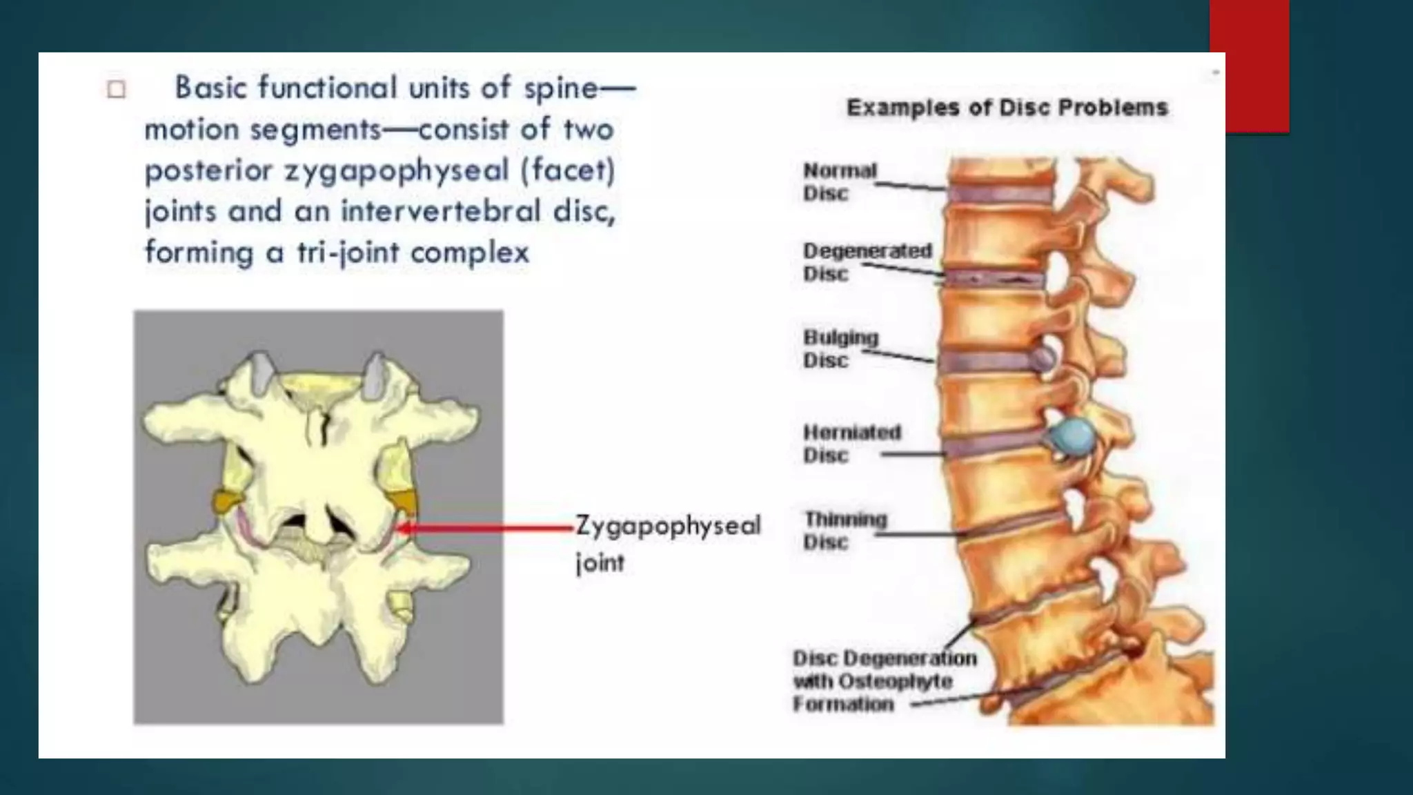 Facet joint syndrome | PPTX