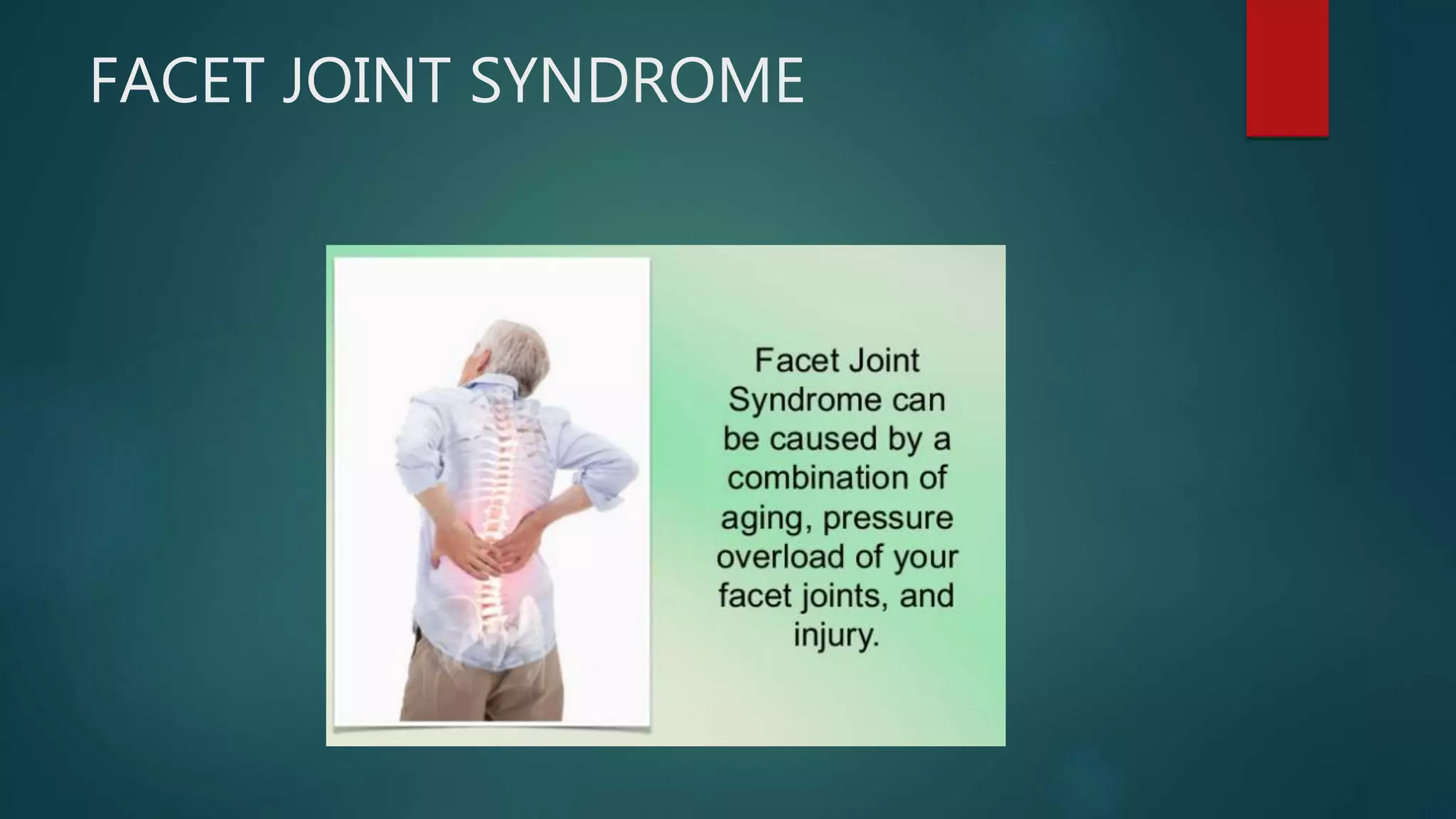 Facet joint syndrome | PPTX