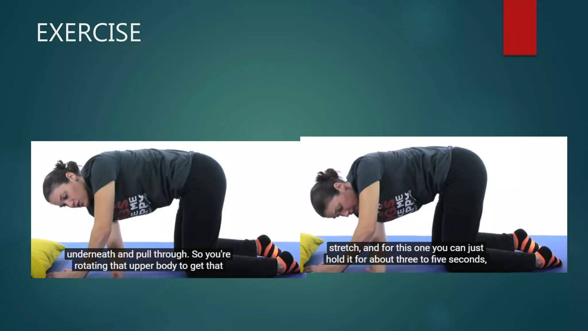 Facet joint syndrome | PPTX