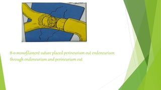 SURICAL ANATOMY OF FACIAL NERVE | PPTX