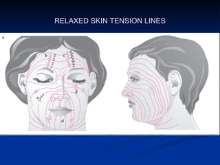 Facial Flap | PPT