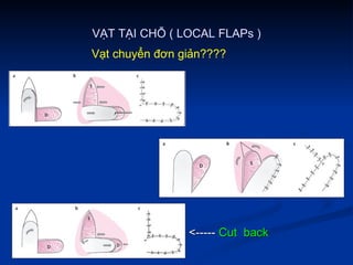 Facial Flap | PPT