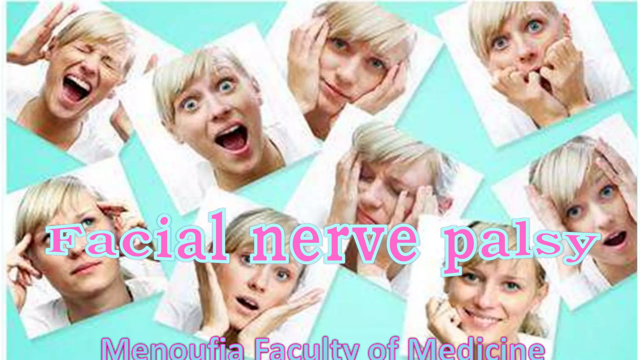 Facial nerve paralysis | PPSX