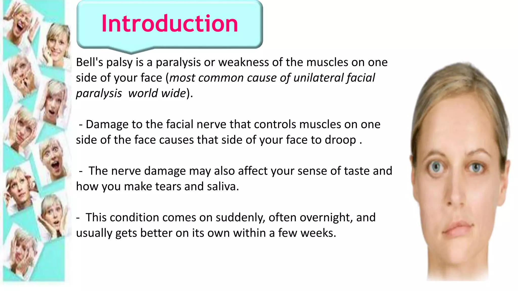 Facial nerve paralysis | PPSX