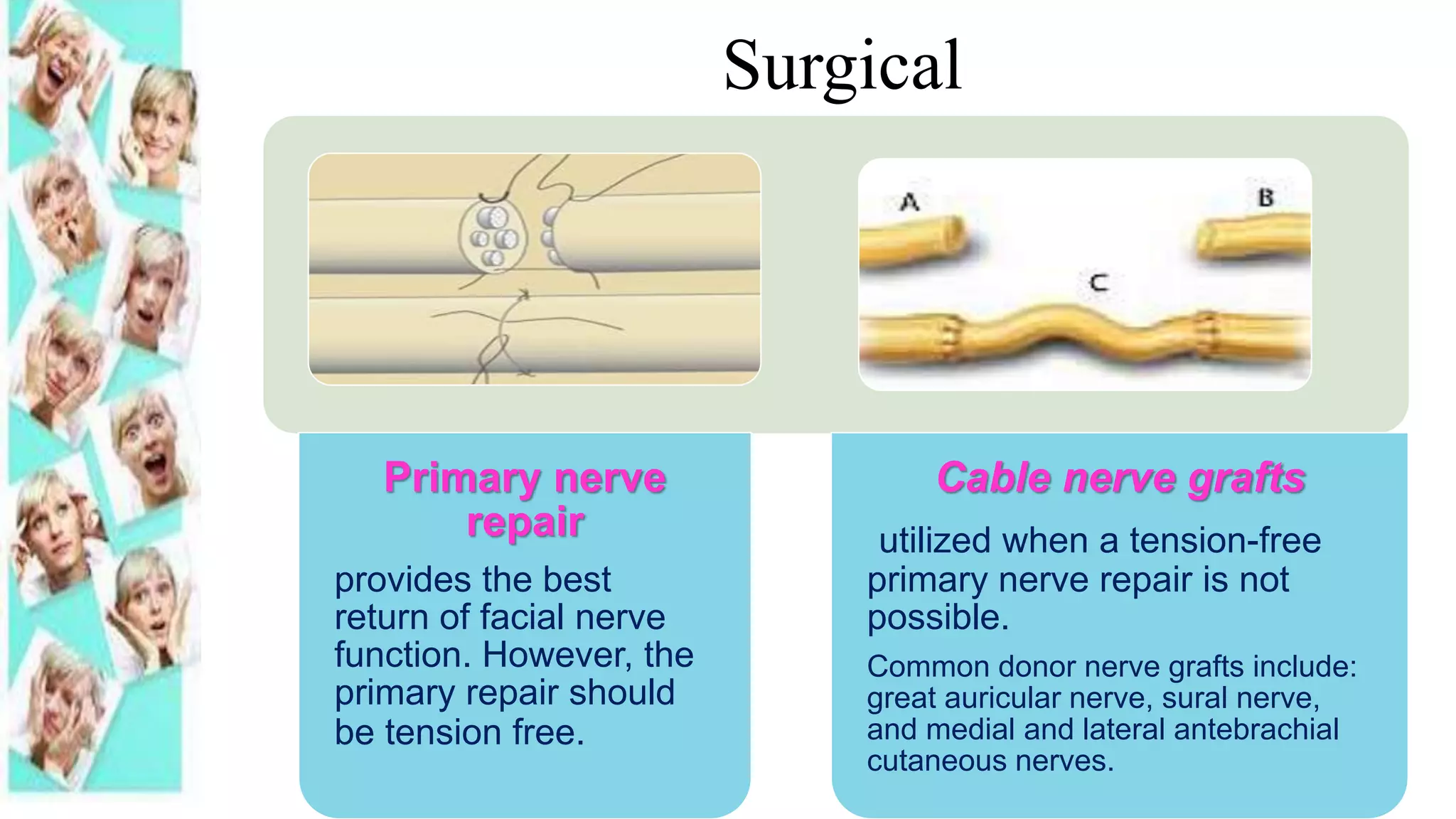 Facial nerve paralysis | PPSX
