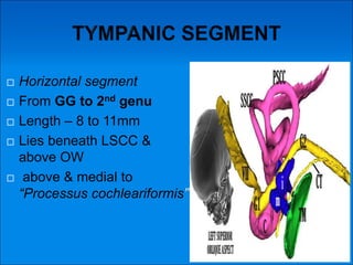 facial-nerve-paralysis.ppt