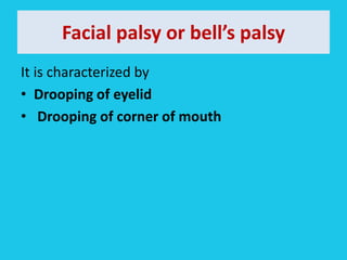 -Facial-Palsy-or-Bell-s-Palsy.pptx