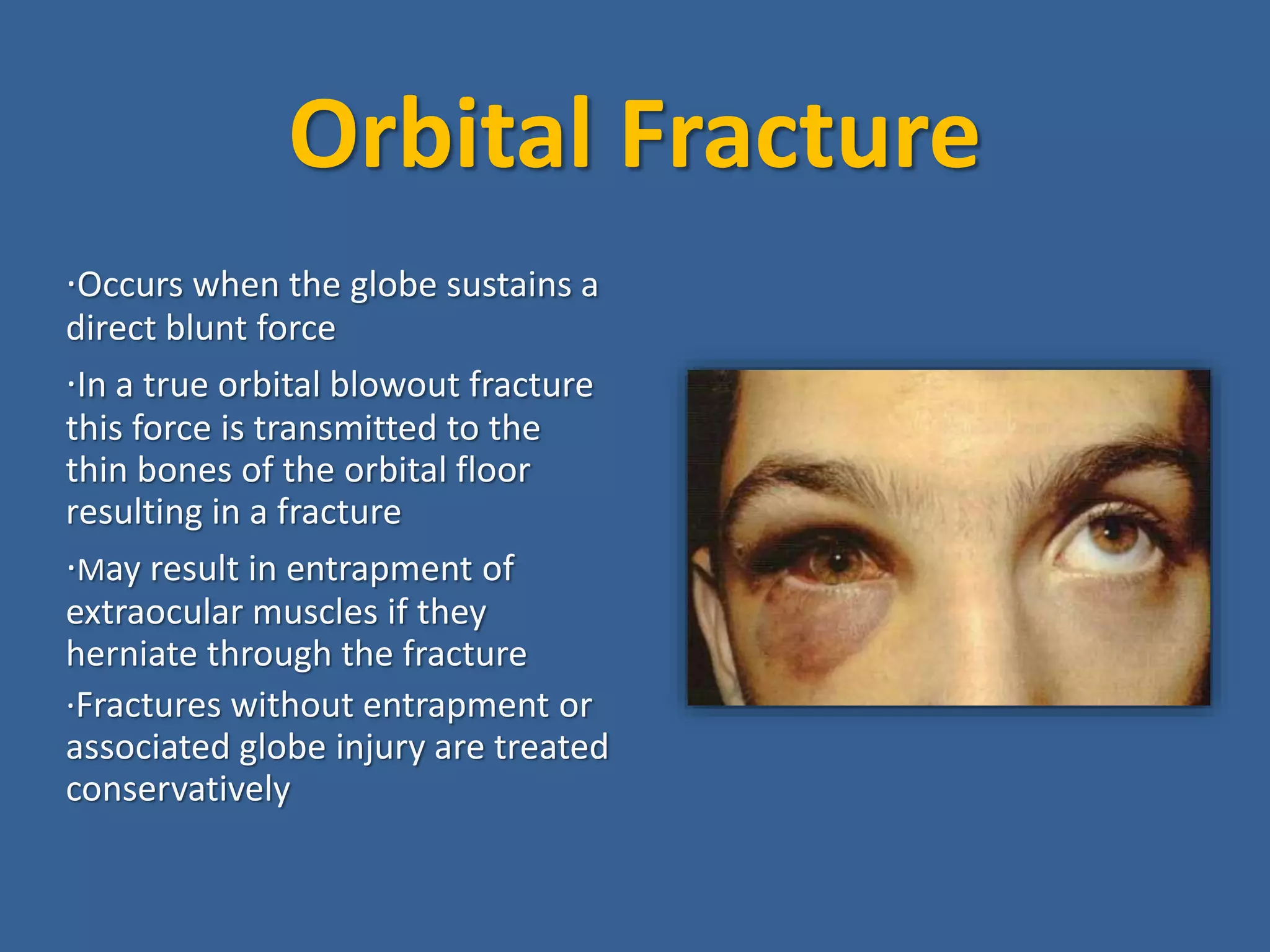 Facial-Trauma-Presentation.pptx