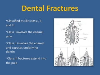 Facial-Trauma-Presentation.pptx