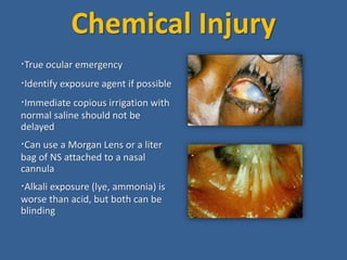 Facial-Trauma-Presentation.pptx