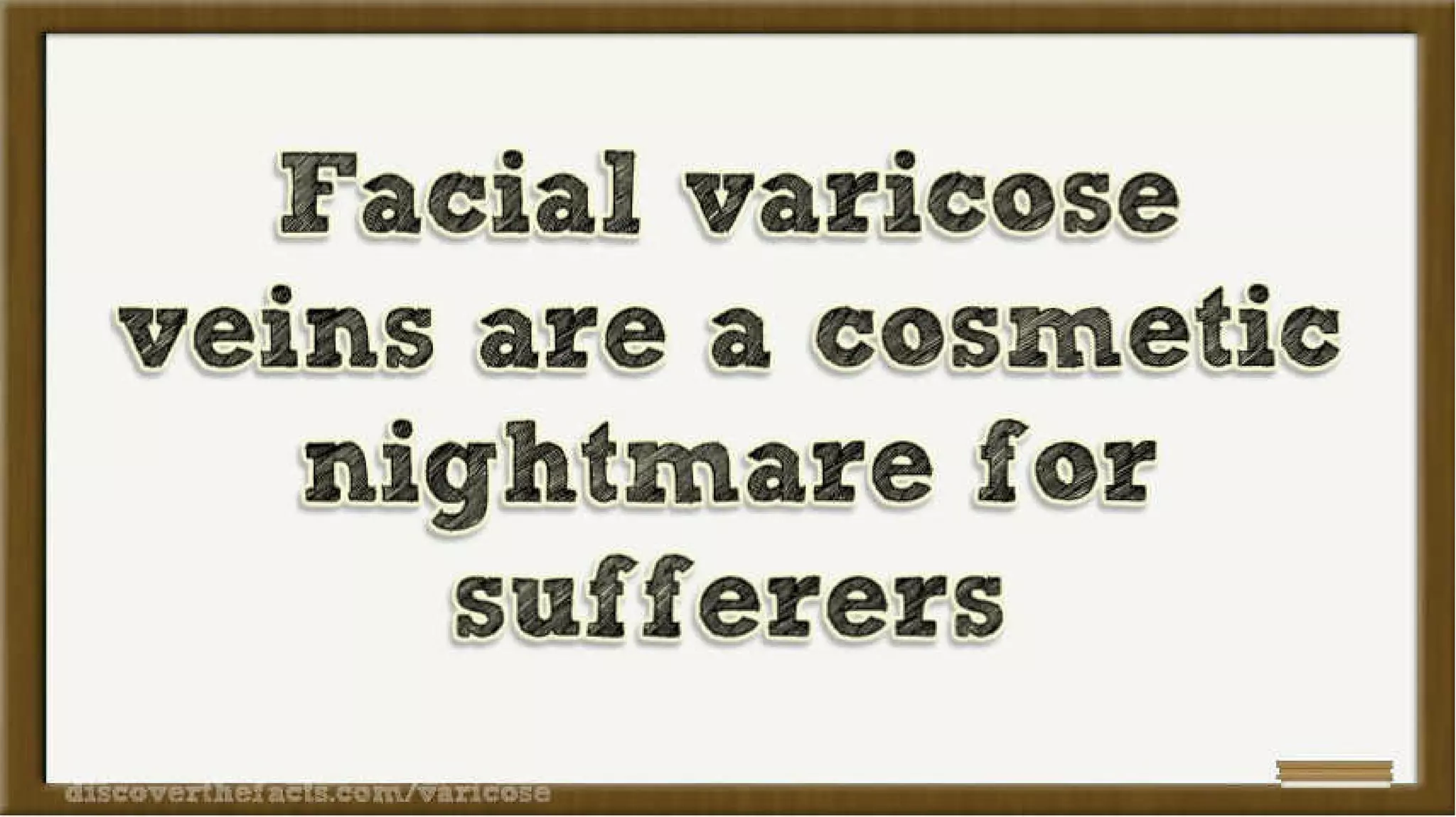 Facial Varicose Veins | ODP