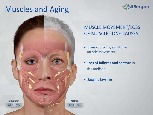 Face age progression - identitykera