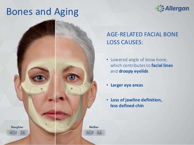 Understanding How The Face Ages