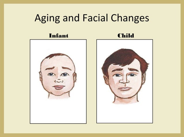 Facial Aging Process by Dr. Kenneth Dickie | PPT