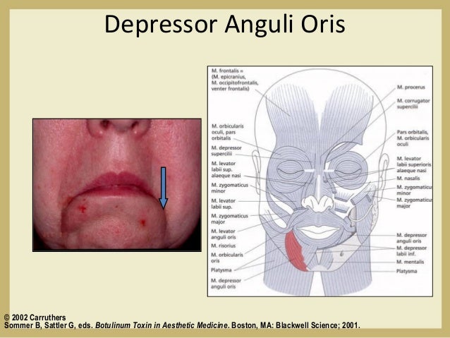 Facial Aging Process by Dr. Kenneth Dickie
