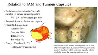 Facial and Hearing Preservation in Acoustic Neuroma Surgery | PPTX