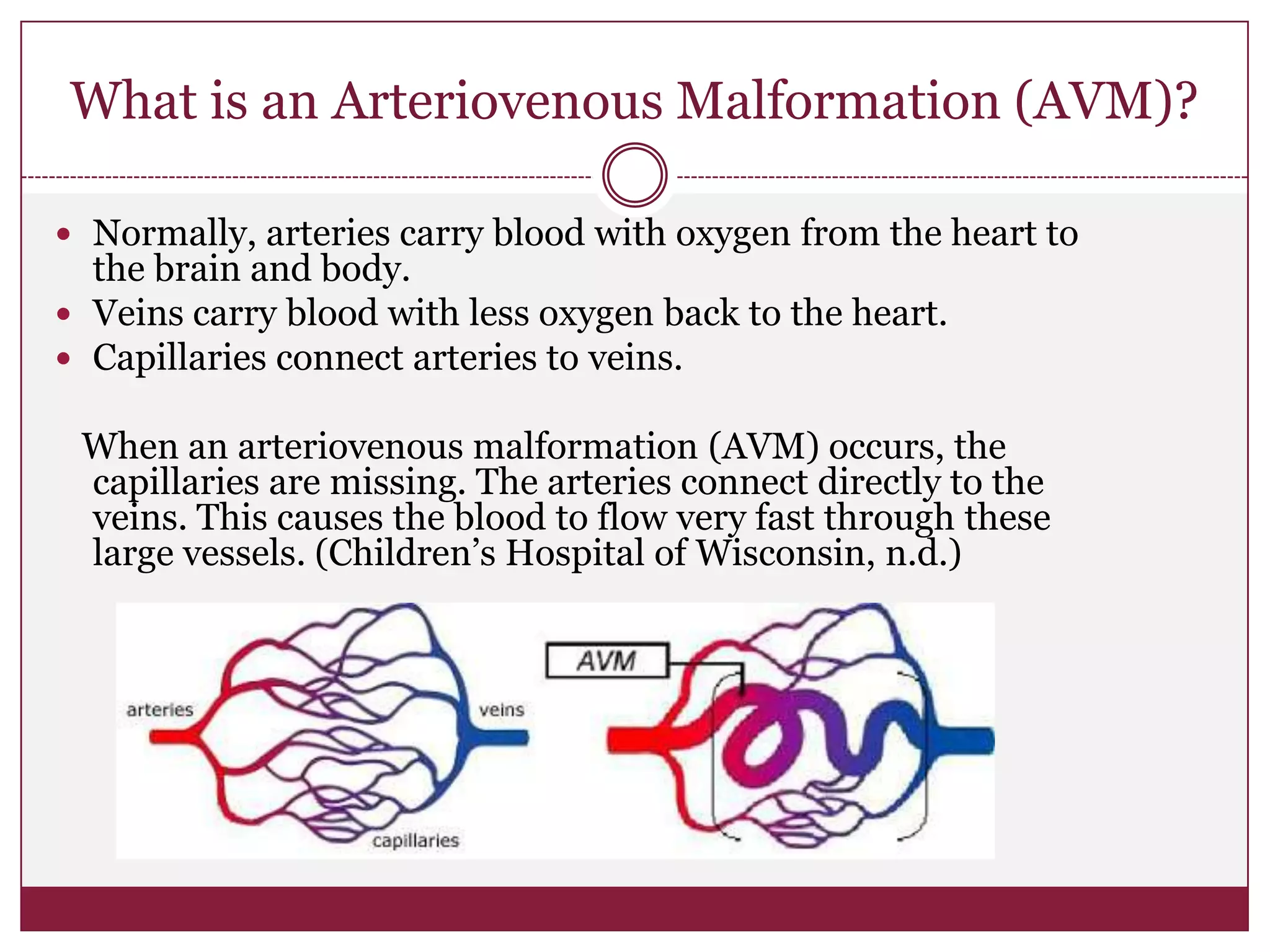 Facial arteriovenous malformations | PPTX