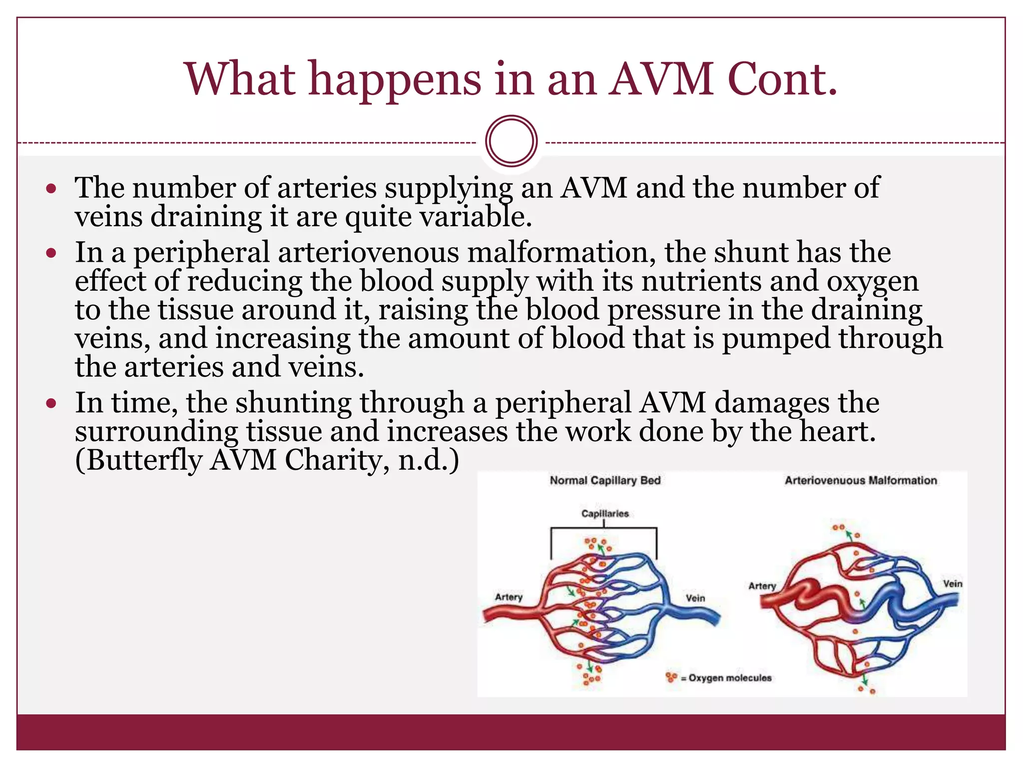 Facial arteriovenous malformations | PPTX