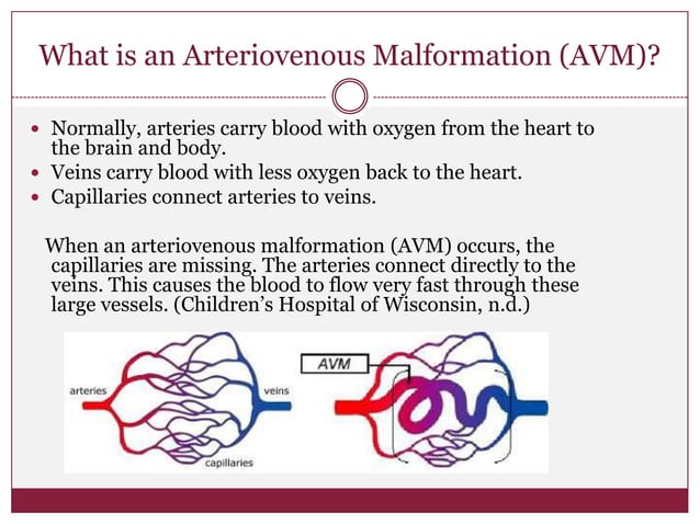 Facial arteriovenous malformations | PPTX | Heart and Cardiovascular Diseases | Diseases and ...