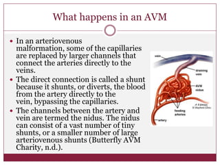 Facial arteriovenous malformations | PPTX