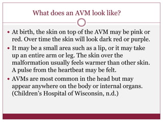 Facial arteriovenous malformations | PPTX