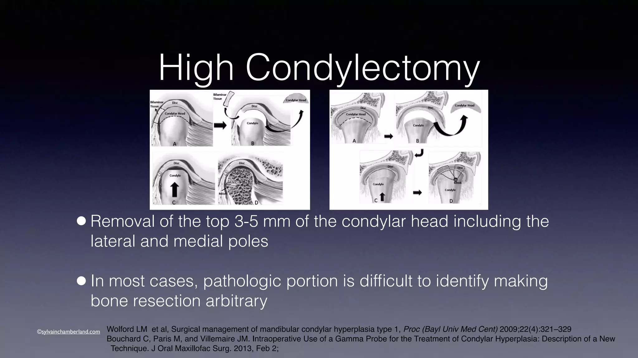 Facial asymmetry condylar hyperplasia or condylar hypoplasia (v a dgkfo ...