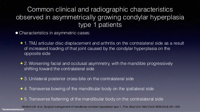 Facial Asymmetry Condylar Hyperplasia Or Condylar Hypoplasia V A Dg