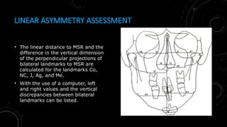 FACIAL ASYMMETRY etiology,diagnosis and managment | PPTX
