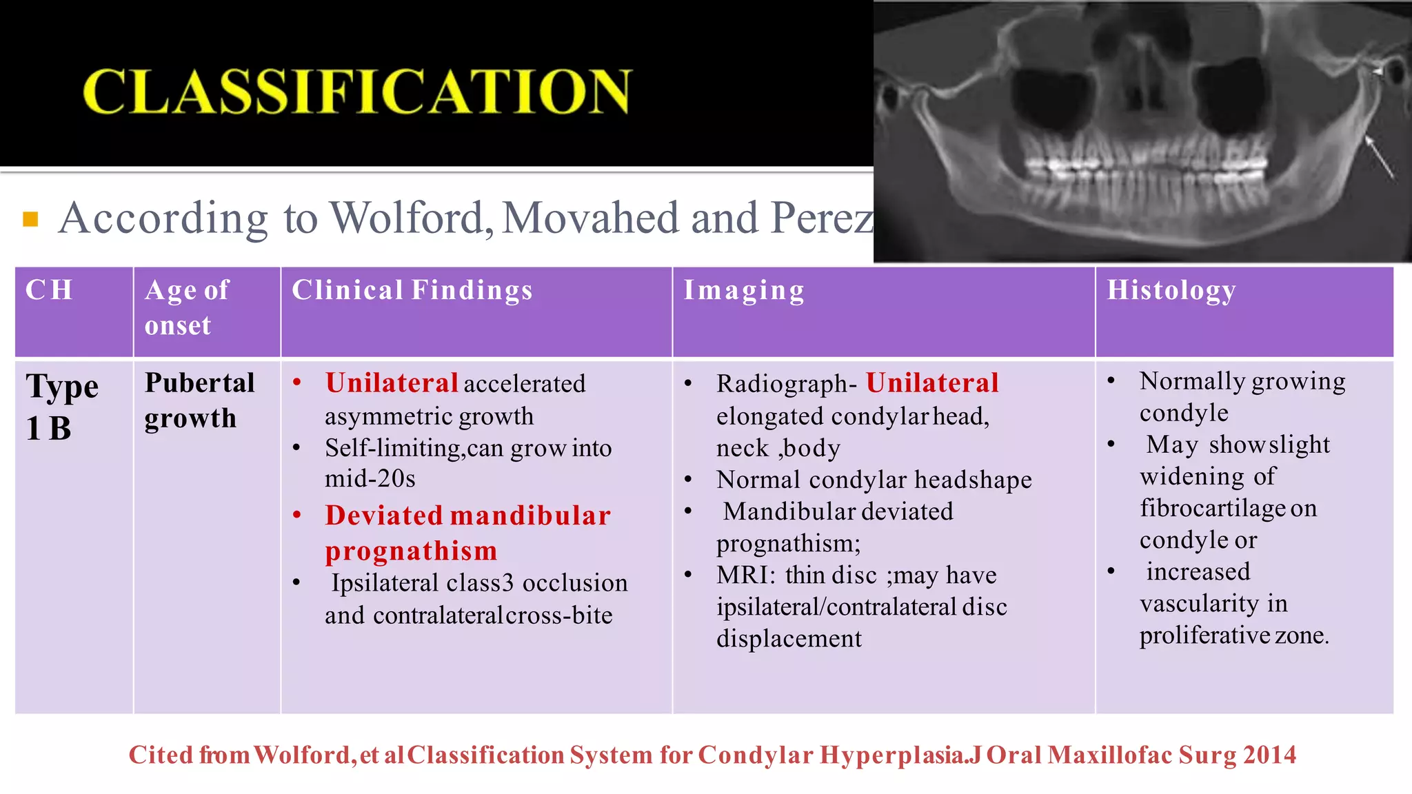 Facial asymmetry condylar hyperplasia and hemifacial microsomia | PPTX