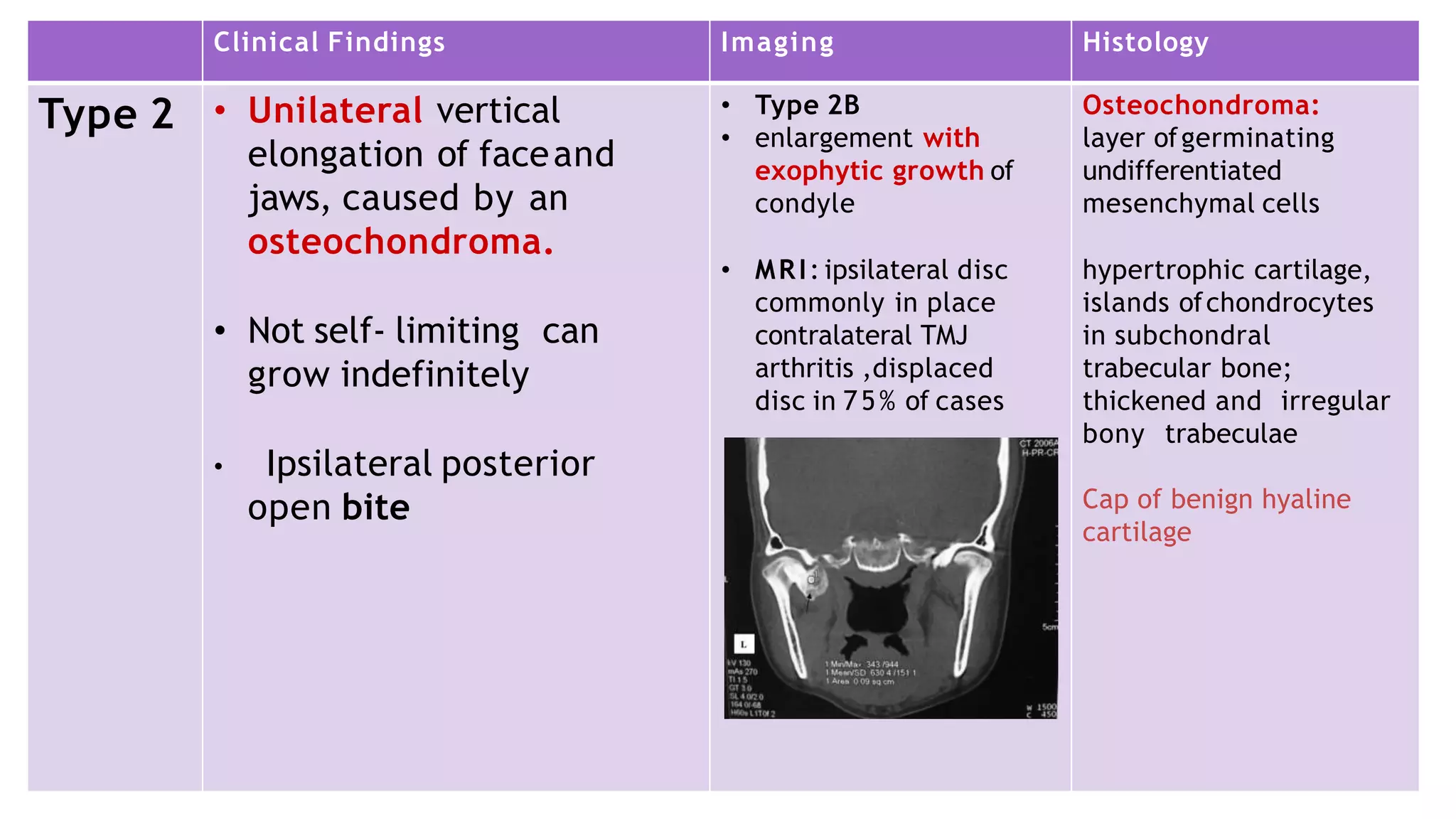 Facial asymmetry condylar hyperplasia and hemifacial microsomia | PPTX