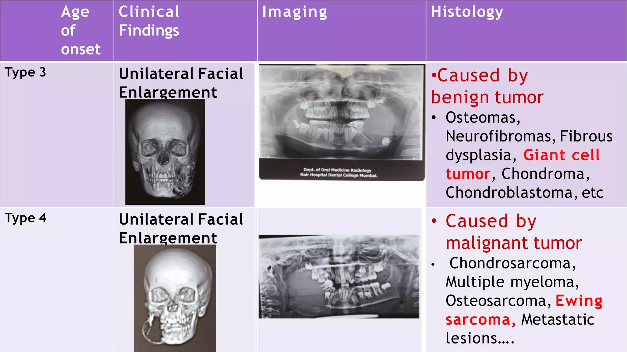 Facial asymmetry condylar hyperplasia and hemifacial microsomia | PPTX