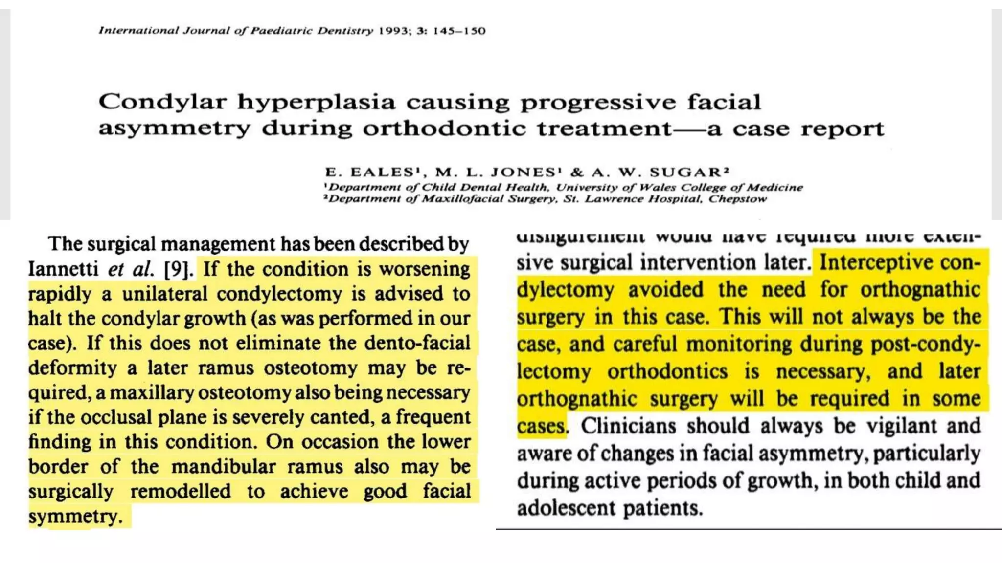 Facial asymmetry condylar hyperplasia and hemifacial microsomia | PPTX