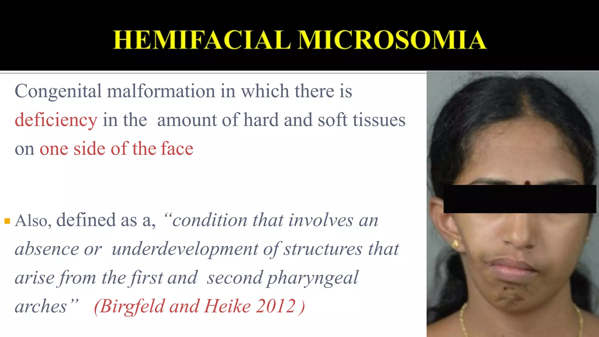 Facial asymmetry condylar hyperplasia and hemifacial microsomia | PPTX