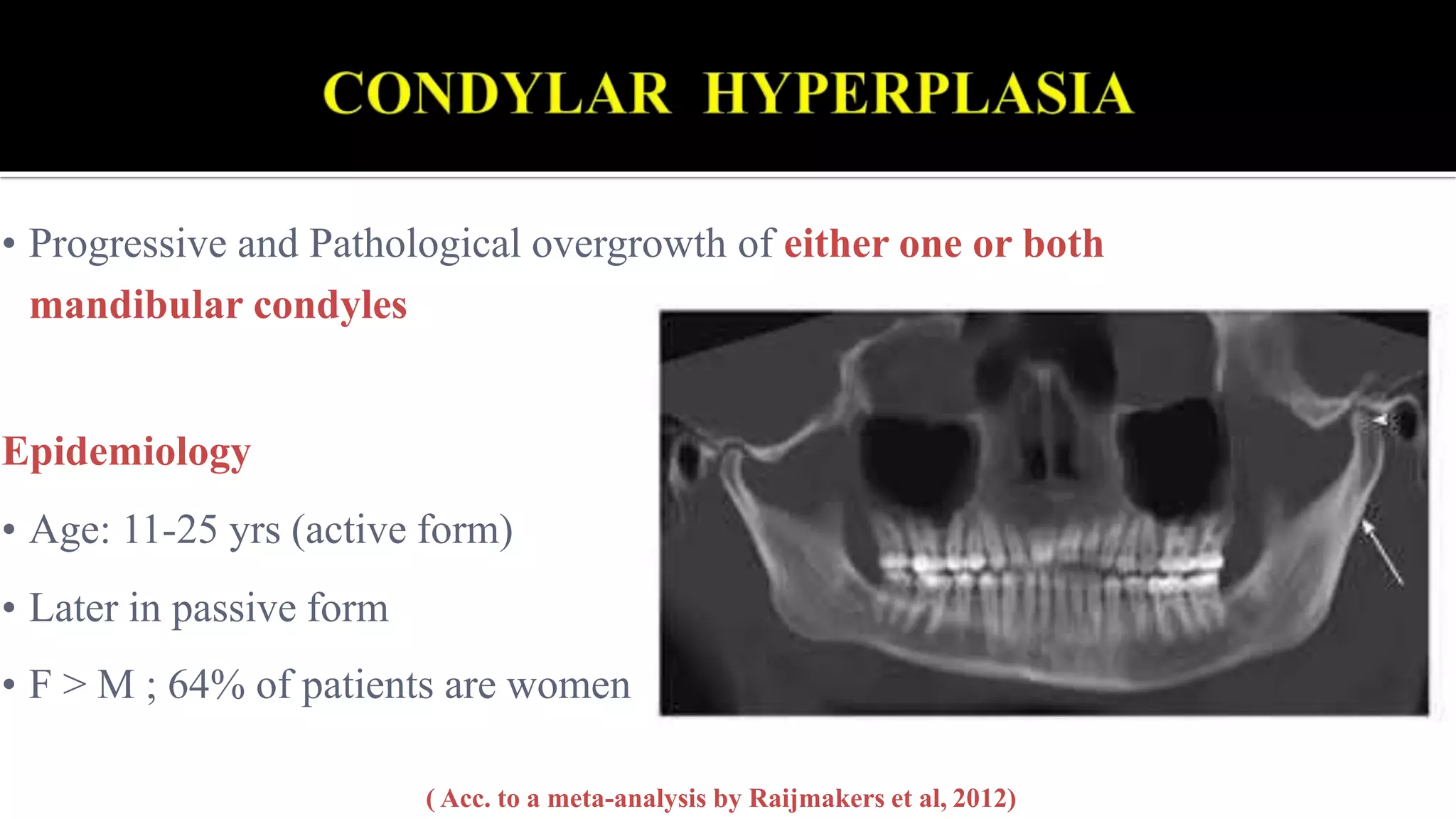 Facial asymmetry condylar hyperplasia and hemifacial microsomia | PPTX