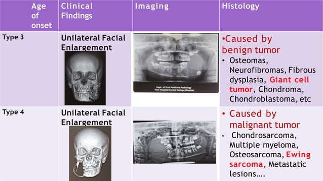 Facial asymmetry condylar hyperplasia and hemifacial microsomia | PPTX ...