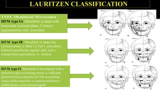 Facial asymmetry condylar hyperplasia and hemifacial microsomia | PPTX